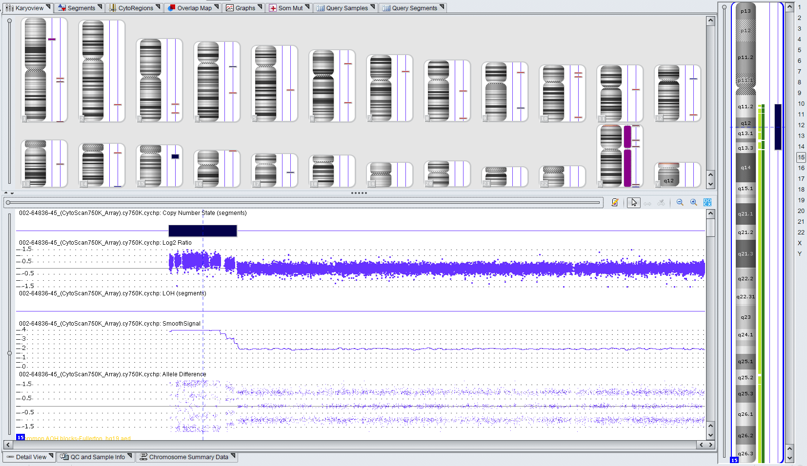 Análise Cromossômica por Microarray | DLE